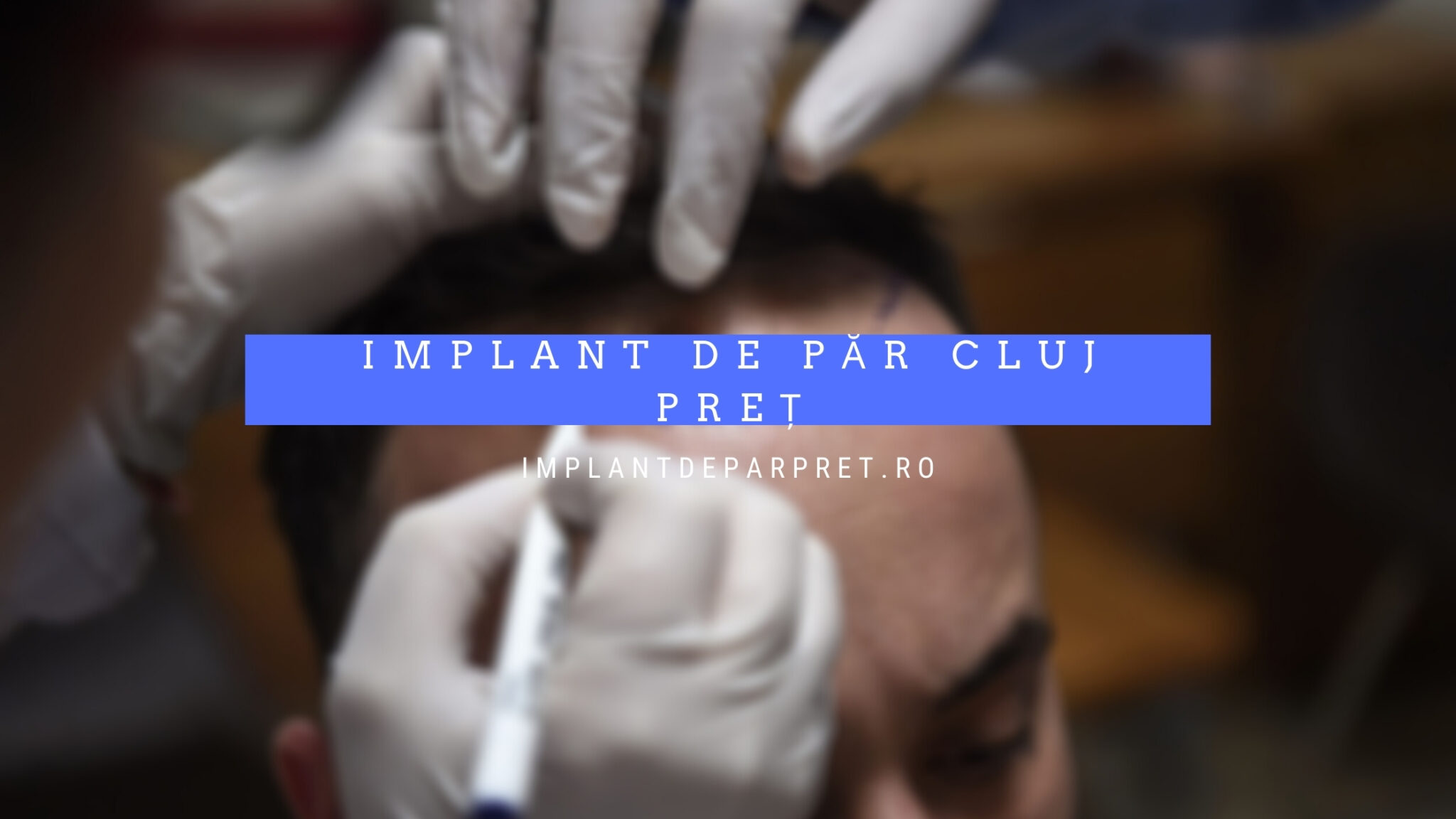 Implant par Cluj pret - Implant Par Pret